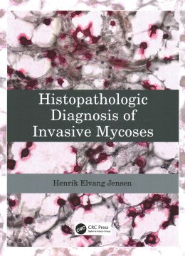 Histopathologic Diagnosis of Invasive Mycoses – MPHOnline.com